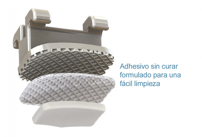 Nu Edge NX® Brackets de Cromo Cobalto con Adhesivo Pre aplicado – TP ...